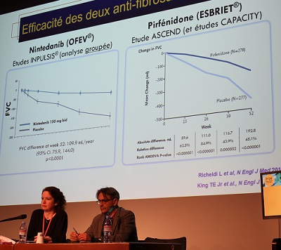 Quoi de neuf dans la FPI ? – Association Fibroses Pulmonaires France